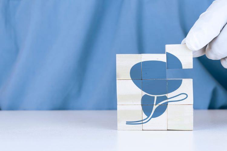 Intravesical drug delivery system exhibits bladder cancer benefit ...