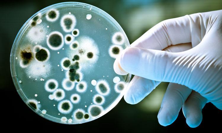 Cleanroom microbiology: single-temperature incubation for EM | Article ...